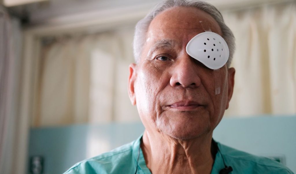 Procedimentos para cirurgia de catarata: veja as etapas | Central da Visão