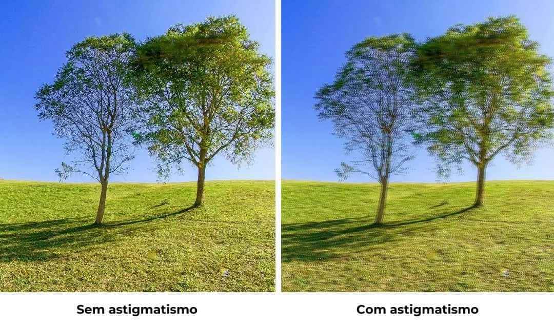 Tudo o que você precisa saber sobre astigmatismo | Central da Visão